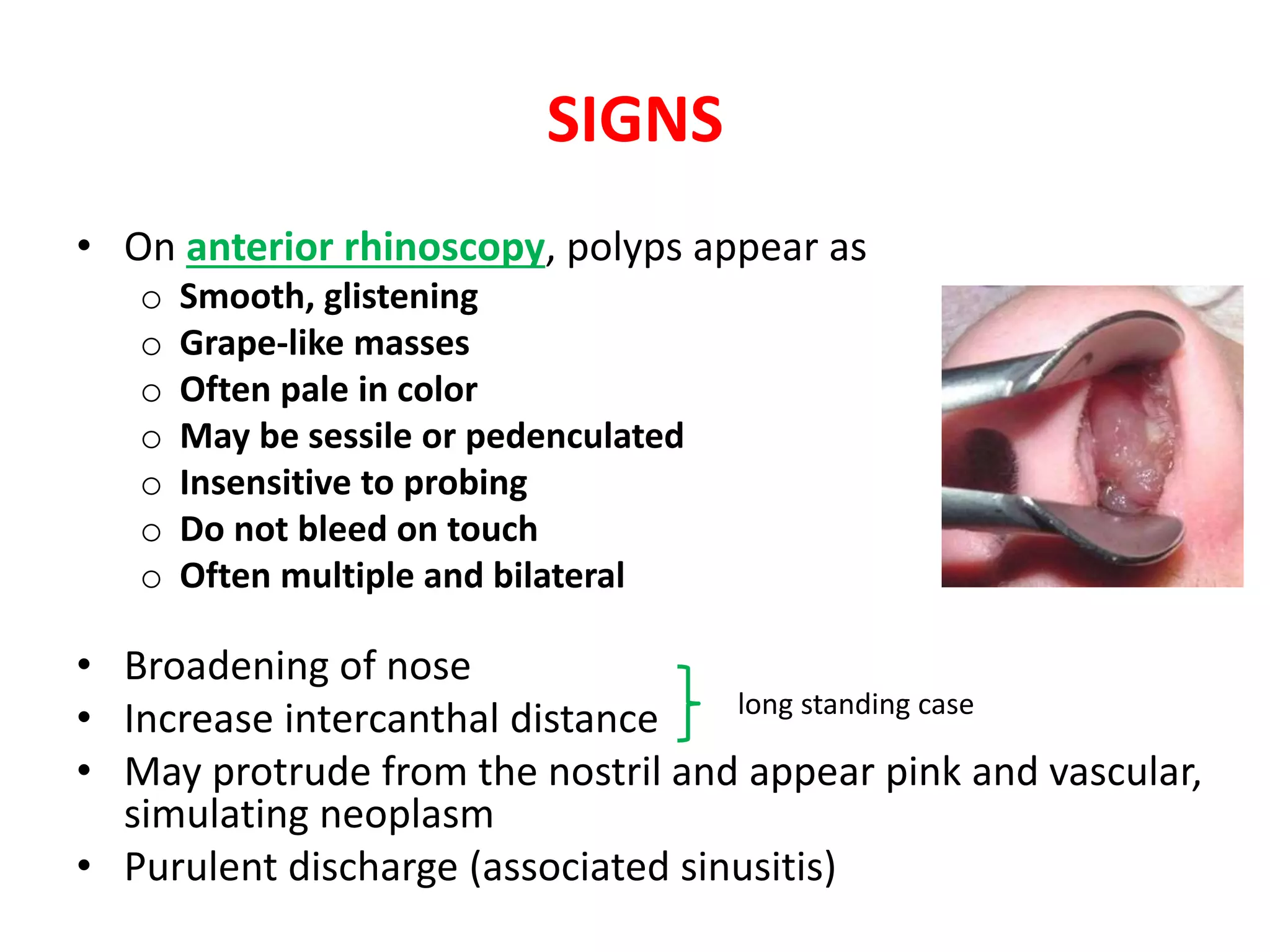 nasal polyp abu zneid.pptx | Ear, Nose and Throat Conditions | Diseases ...