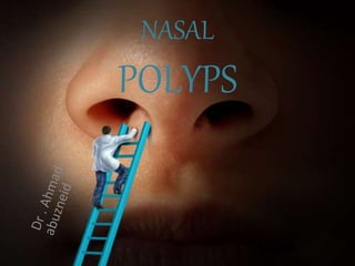 nasal polyp abu zneid.pptx | Ear, Nose and Throat Conditions | Diseases and Conditions