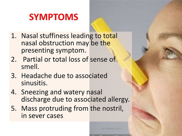 nasal polyp abu zneid.pptx | Ear, Nose and Throat Conditions | Diseases ...