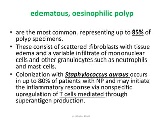 nasal polyp abu zneid.pptx | Ear, Nose and Throat Conditions | Diseases ...