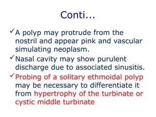 Nasal.............. polyp by Definet.pptx