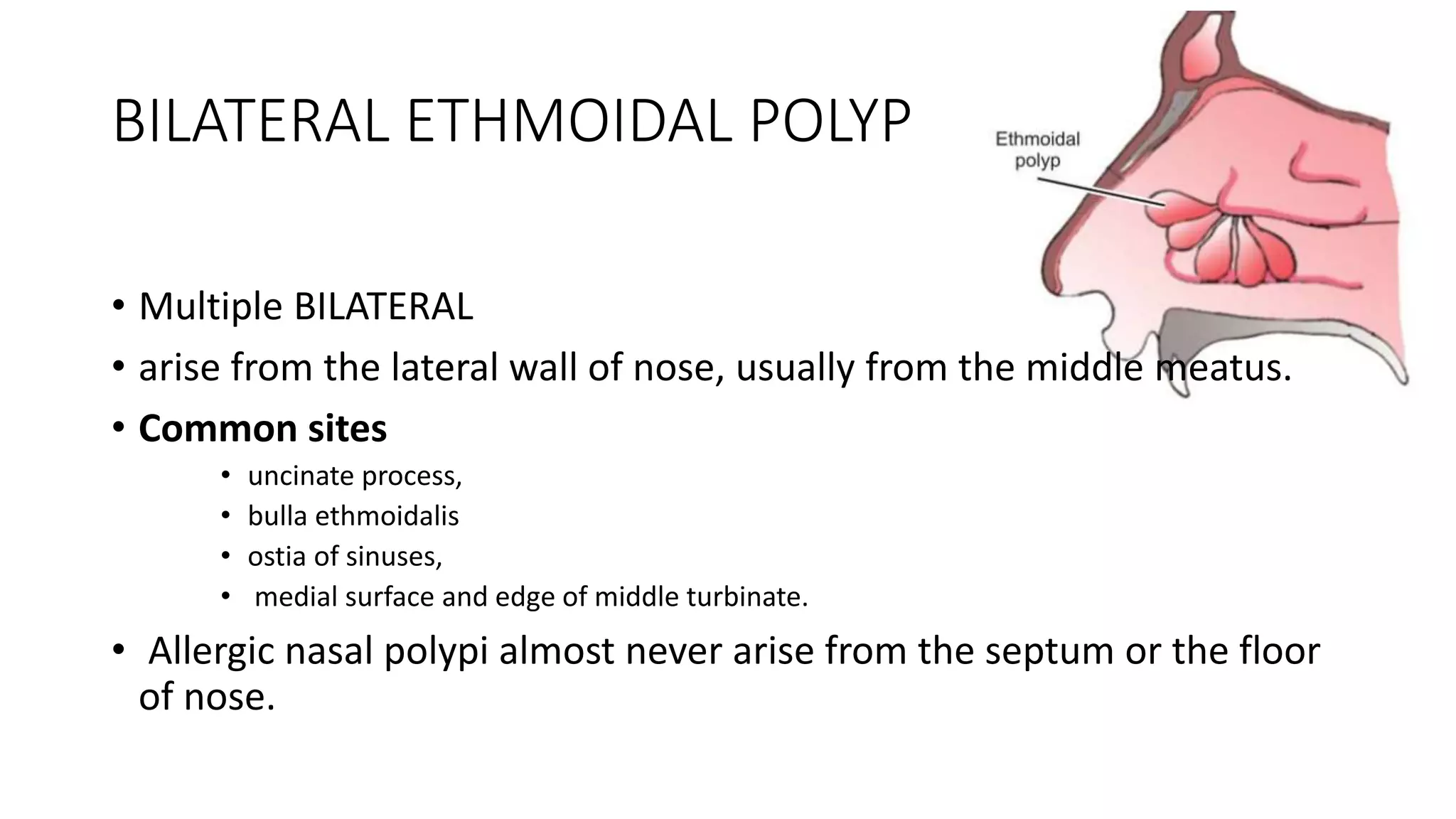 Nasal polypi otorhinolaryngology types etiology management ent ppt | PPTX