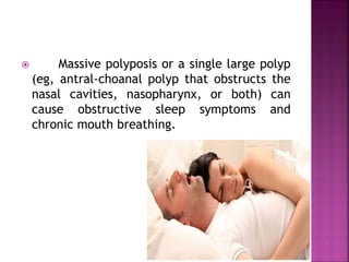 Nasal polyposis | PPTX | Ear, Nose and Throat Conditions | Diseases and ...