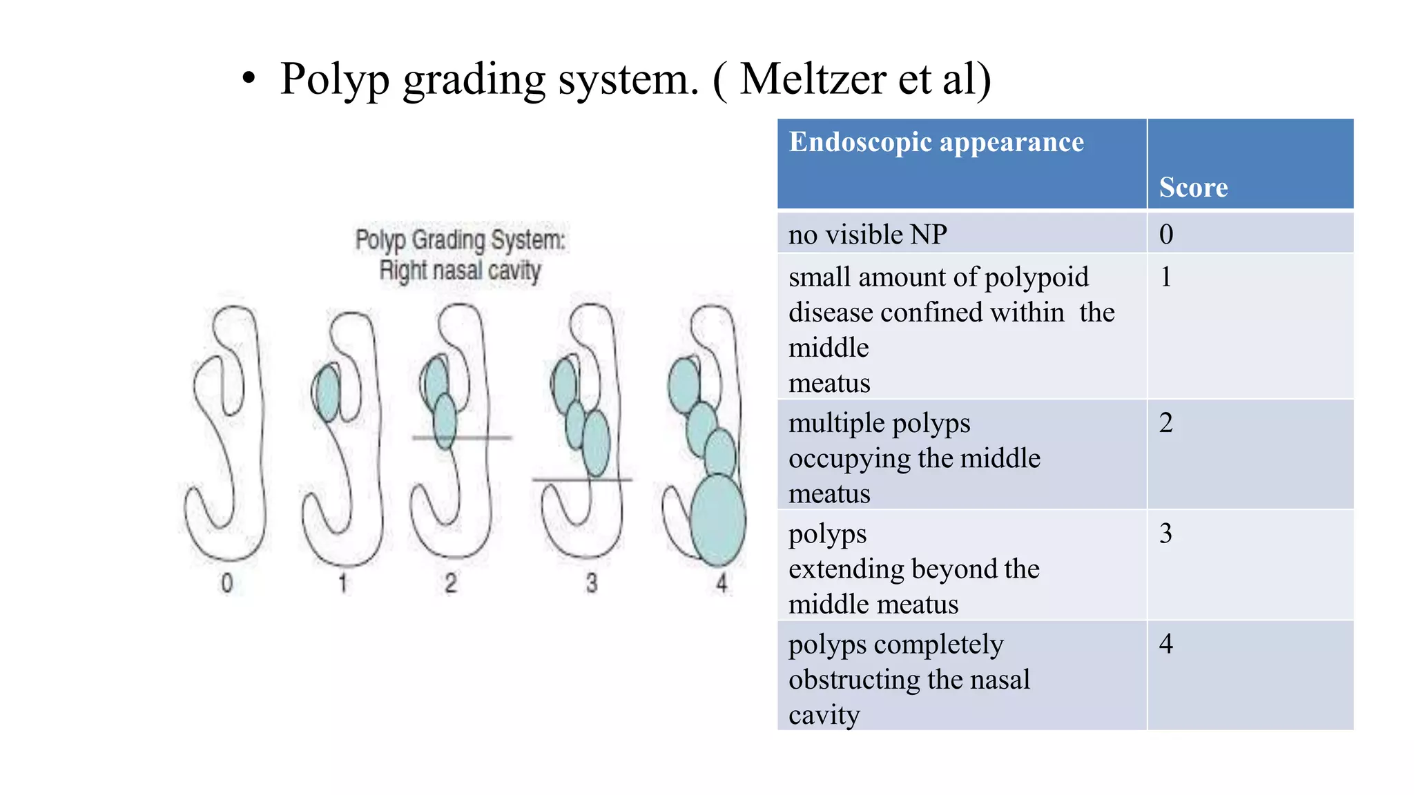 Nasal polyposis | PPTX