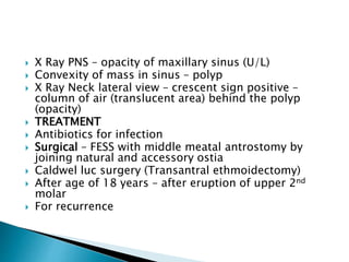 Nasal polyposis | PPTX