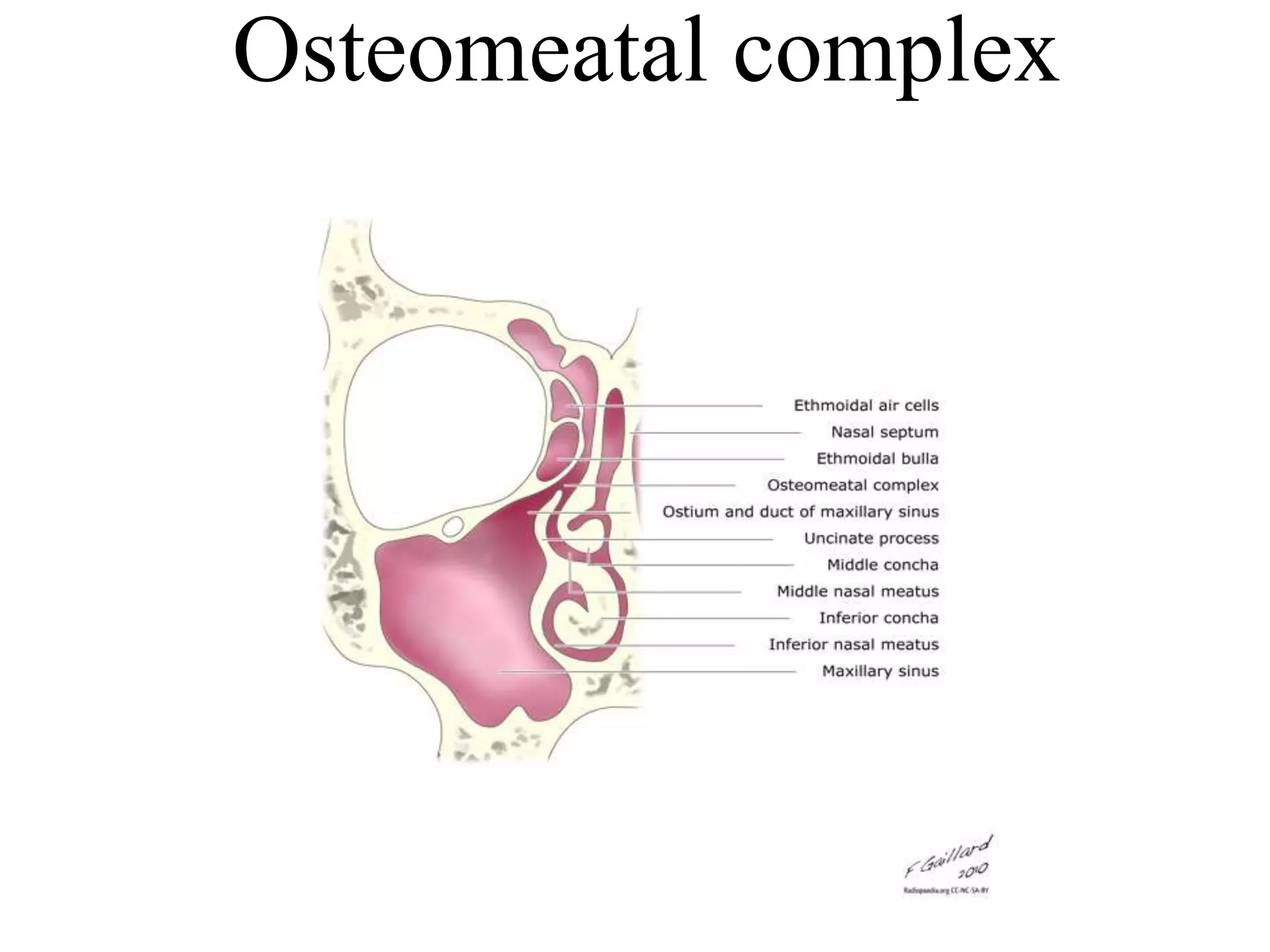 Nasal Polyposis.pptx