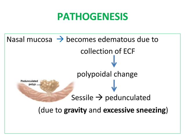 nasalpolyp | PPT