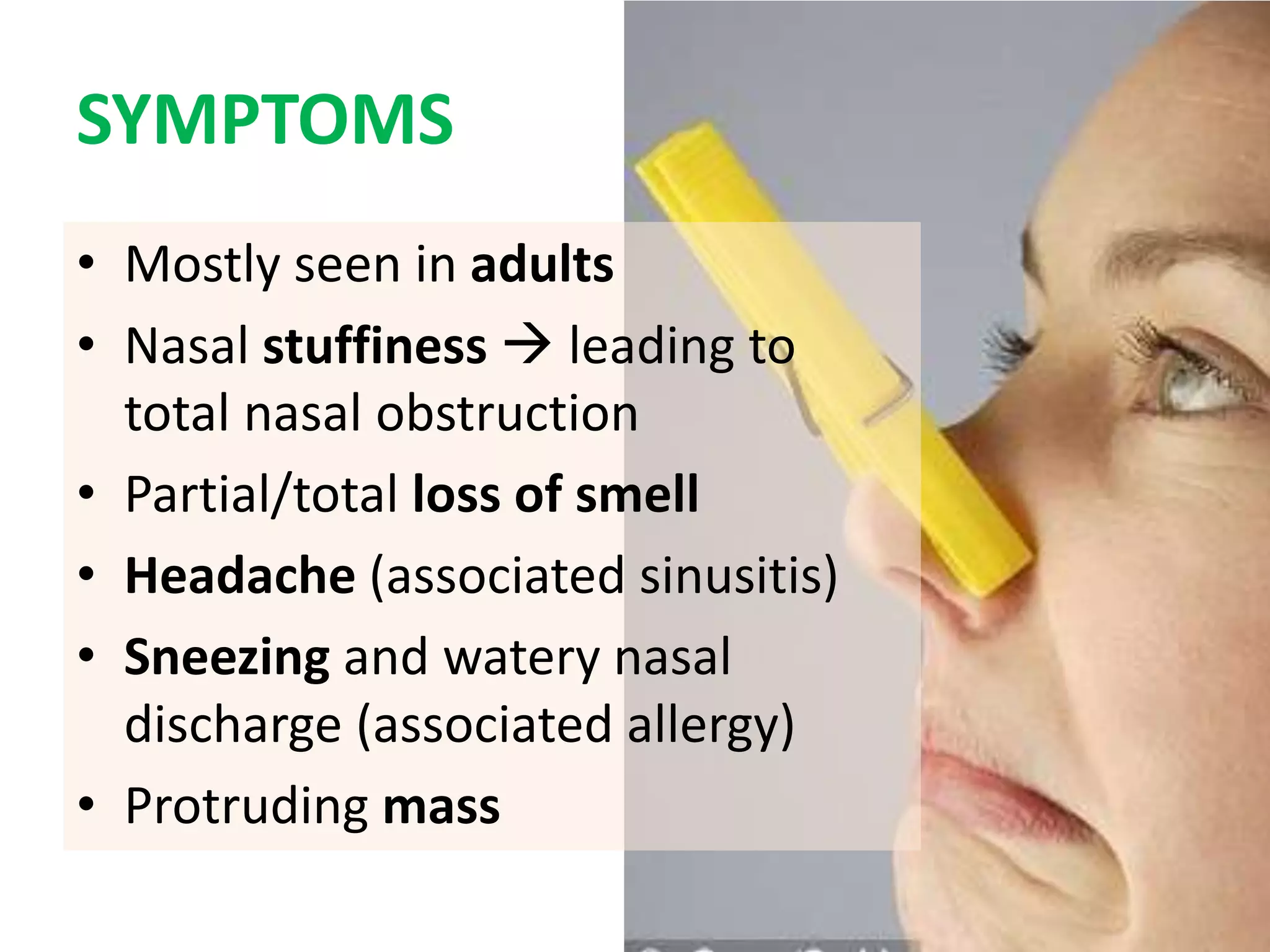 NASAL POLYPS | PPTX
