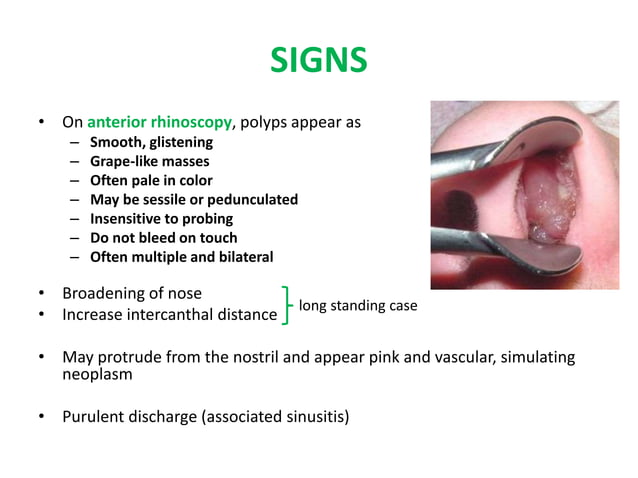NASAL POLYPS | PPTX | Ear, Nose and Throat Conditions | Diseases and ...