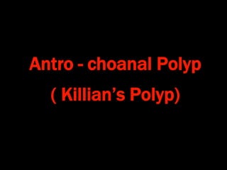 Nasal polyps | PPT