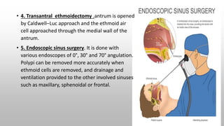 nasal polyps | PPTX | Ear, Nose and Throat Conditions | Diseases and ...