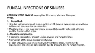 nasal polyps | PPTX
