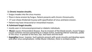 nasal polyps | PPTX