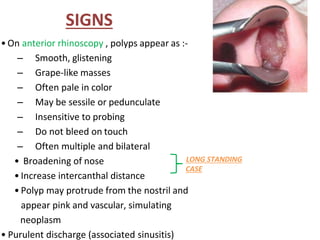 Nasalpolyps | PPTX