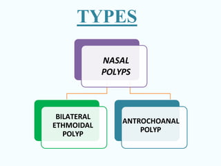 Nasalpolyps | PPTX