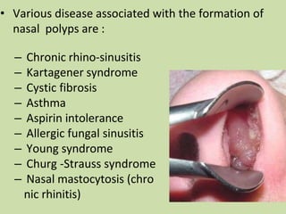 Nasalpolyps | PPTX