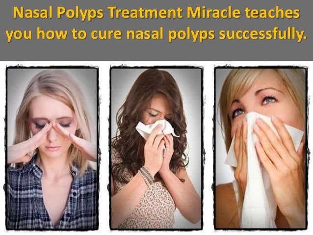 Nasal Polyps Treatment Miracle Teaches You How To Cure Nasal Polyps S