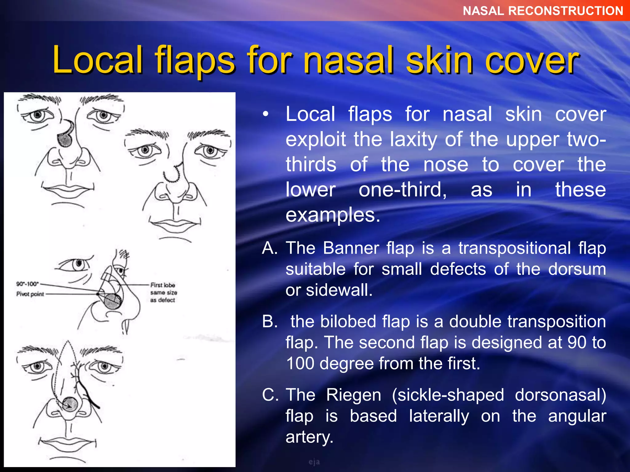NASAL RECONSTRUCTION BY HUSSEIN ABULHASSAN | PPT