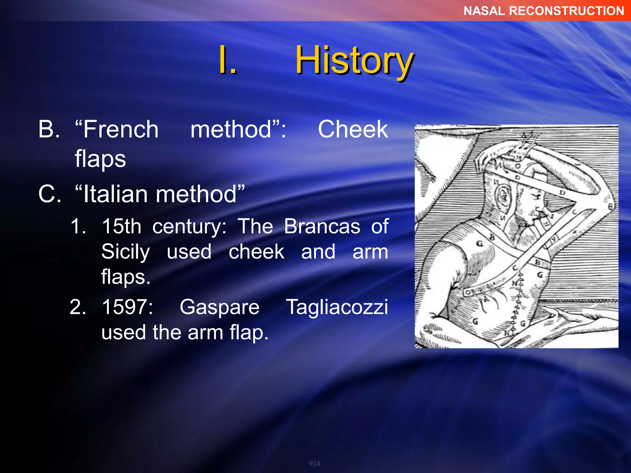 NASAL RECONSTRUCTION BY HUSSEIN ABULHASSAN | PPT