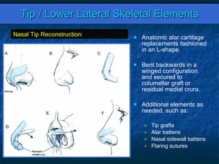 Nasalreconstructiongrandrounds043009 | PPT