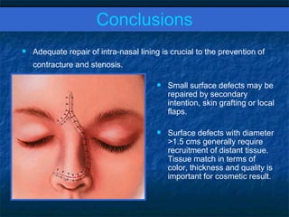 Nasalreconstructiongrandrounds043009 | PPT