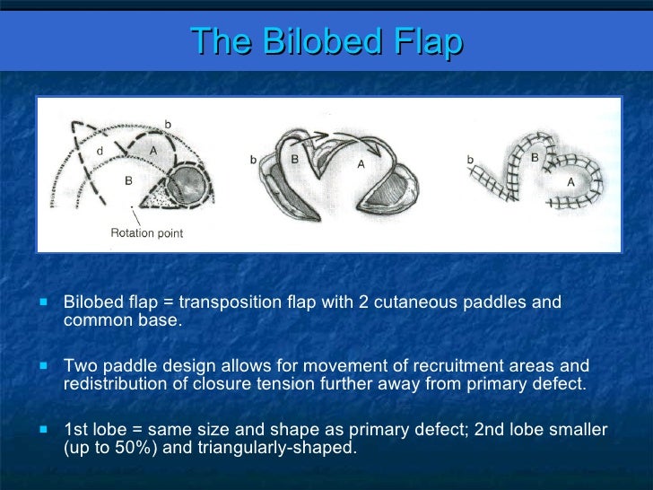 Nasalreconstructiongrandrounds043009