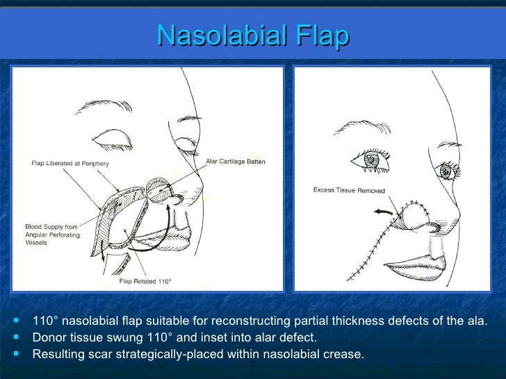 Nasalreconstructiongrandrounds043009
