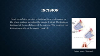 Nasal septal anatomy and septoplasty | PPTX | Ear, Nose and Throat ...