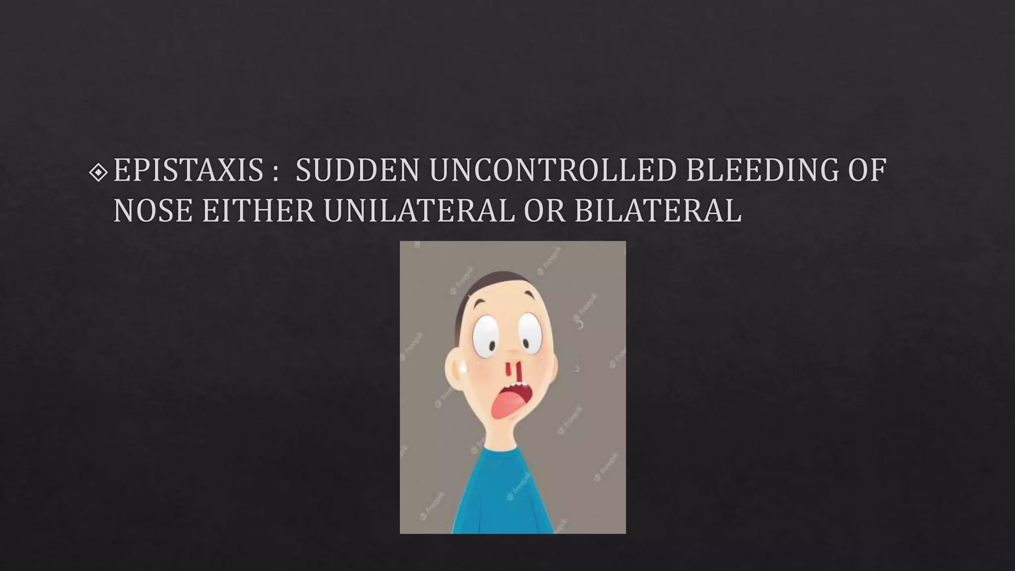 Nasal septal fractures | PPTX