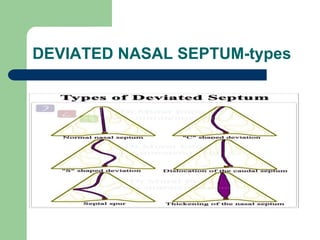 nasal septum.pptx