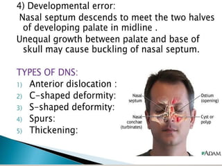 2 Nasal Septum Anatomy, DNS, Surgery by RA Ritesh.pptx