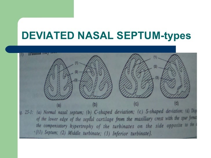 Nasal septum and its diseases