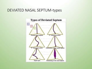 nasalseptumanditsdiseases................ | PPT
