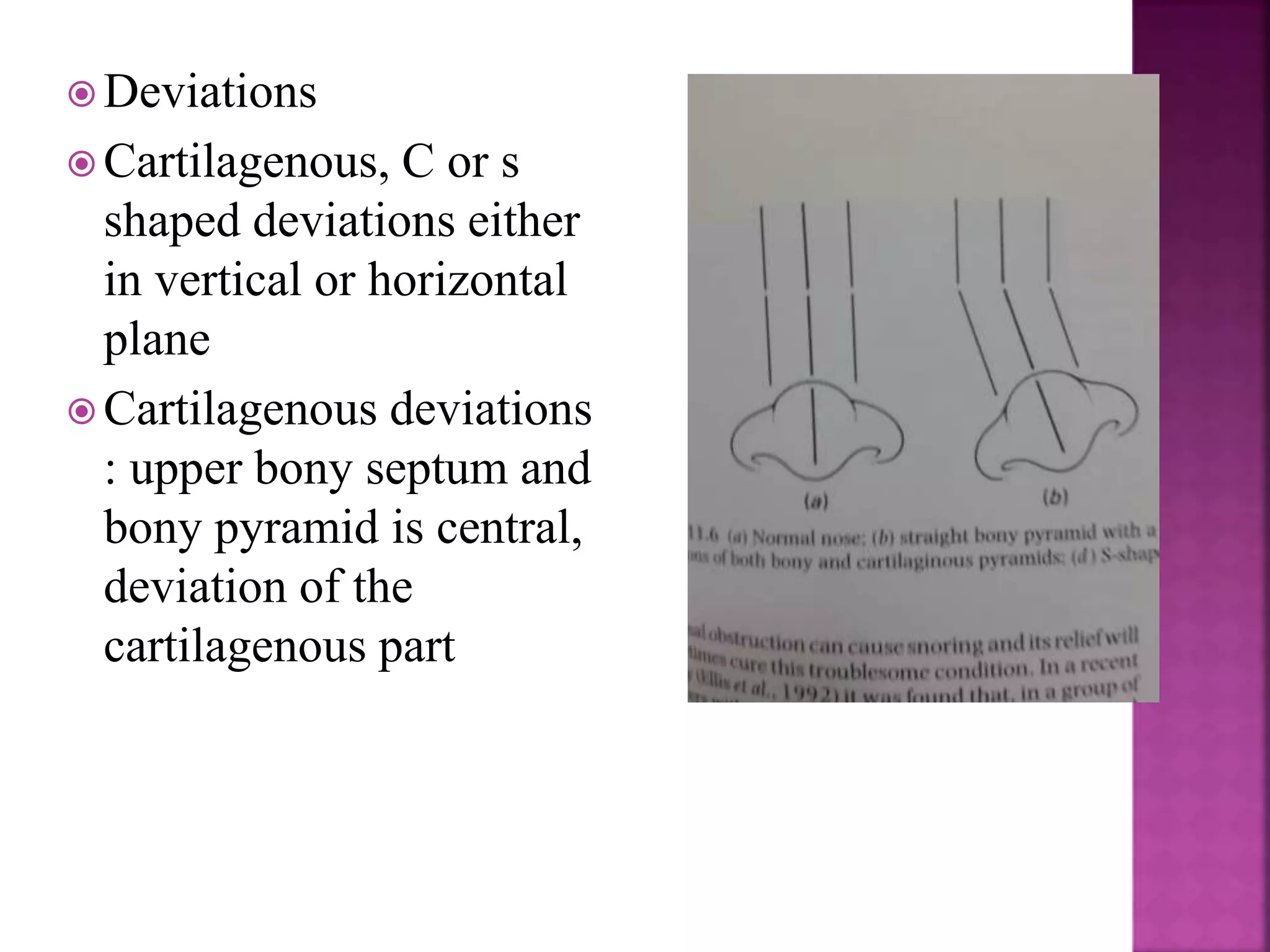 Nasal septum and its diseases[1] | PPT