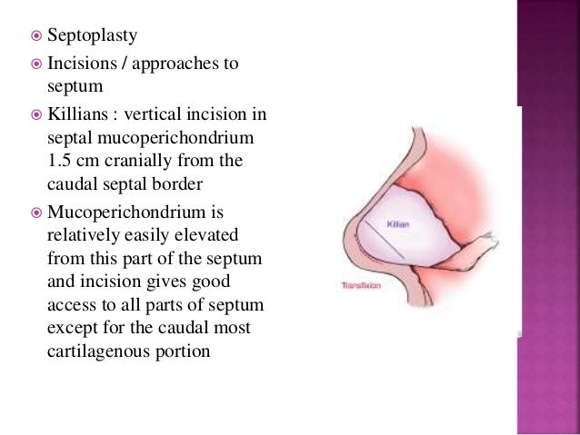 Nasal septum and its diseases[1]