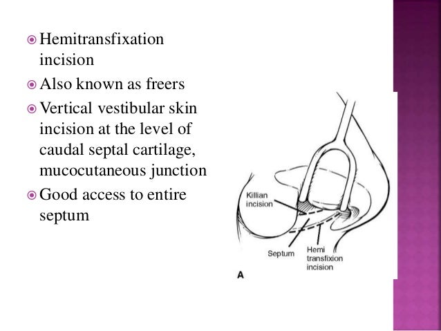 Nasal septum and its diseases[1]