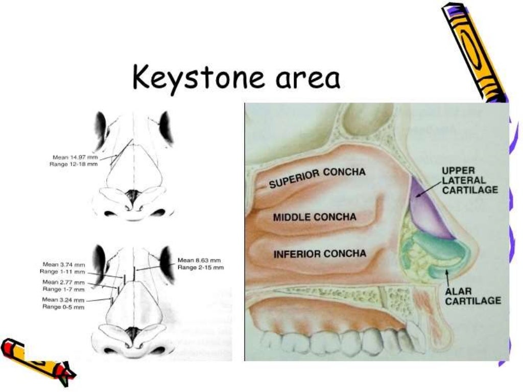Nasal septum & septoplasty