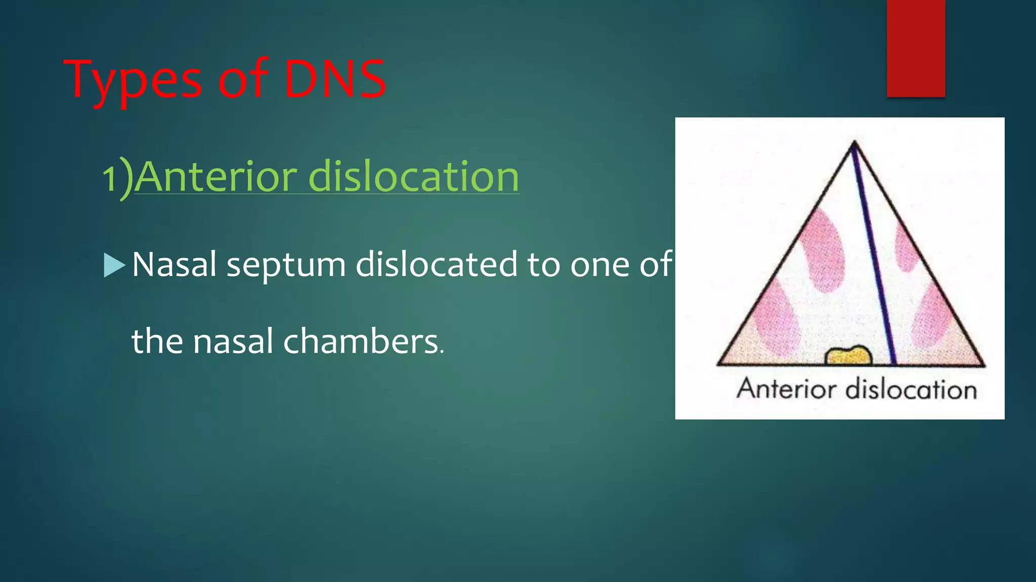 Nasal septum & its diseases | PDF