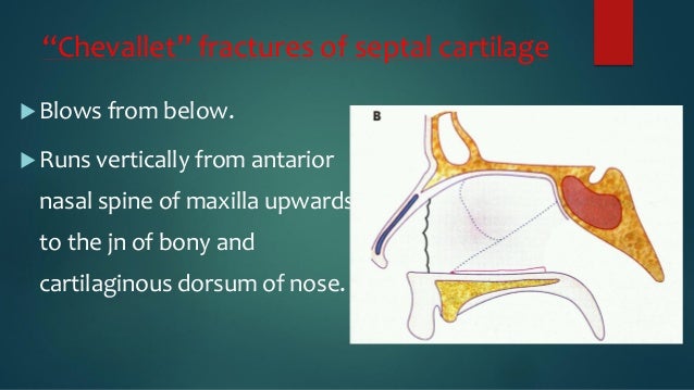 Nasal septum & its diseases