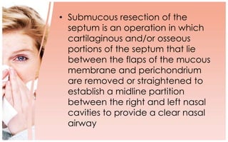 Nasal surgery | PPTX