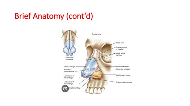 Nasal trauma, septal hematoma and nasal abscess..pptx