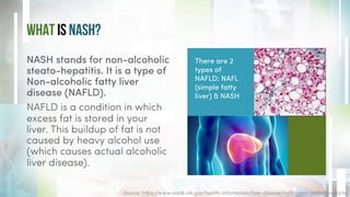 Currently Emerging: NASH (Non-Alcoholic Steato-Hepatitis) | PDF ...