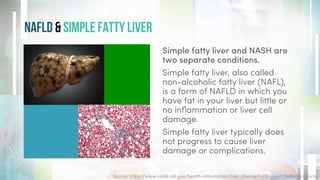 Currently Emerging: NASH (Non-Alcoholic Steato-Hepatitis) | PDF ...