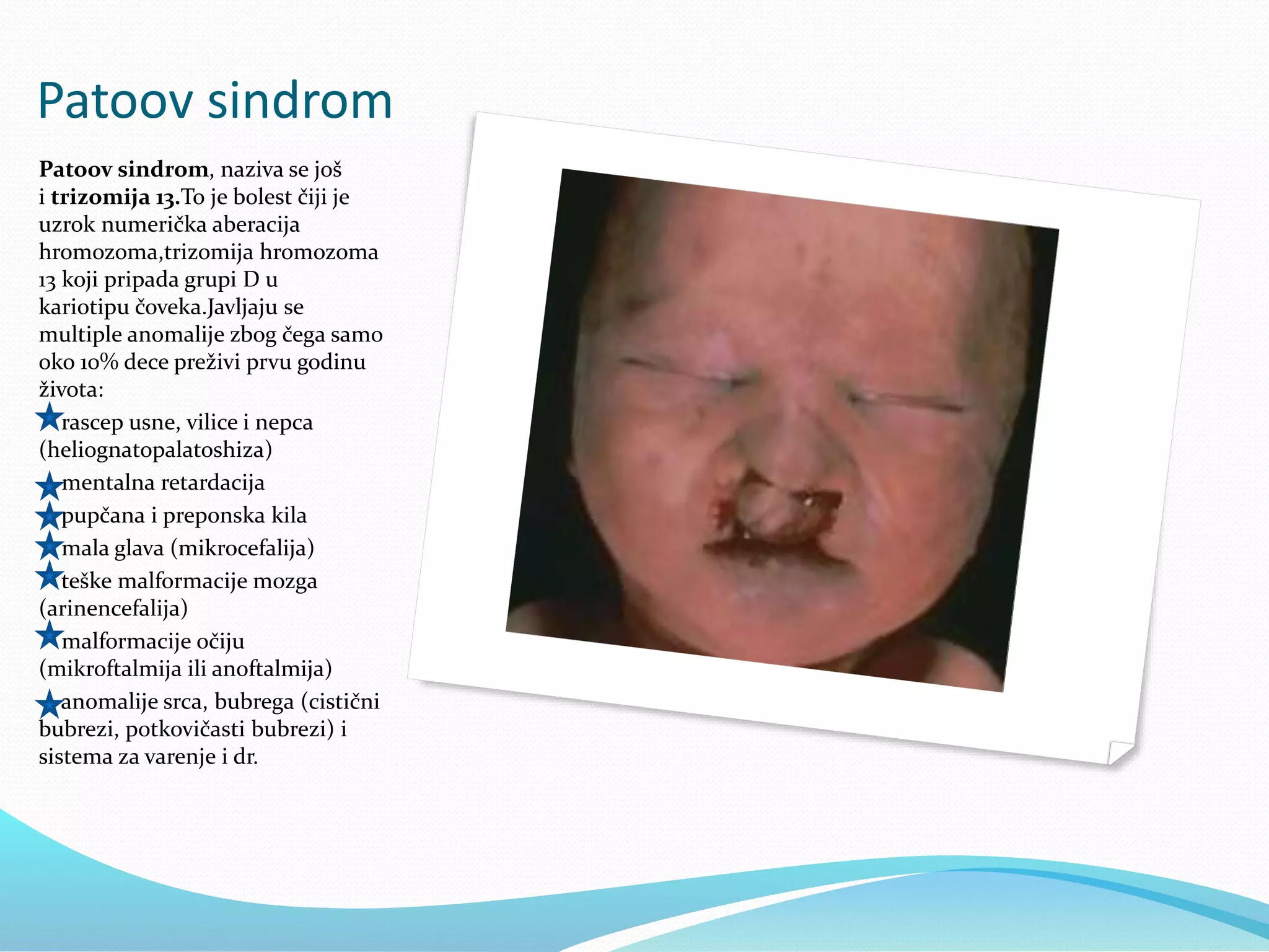 Наследне болести - урадила Марина Трајановић | PPTX