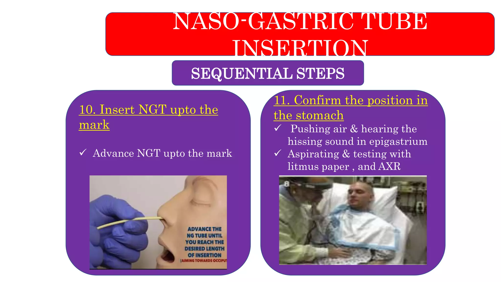 Naso gastric tube insertion- skill lab- osce | PPTX