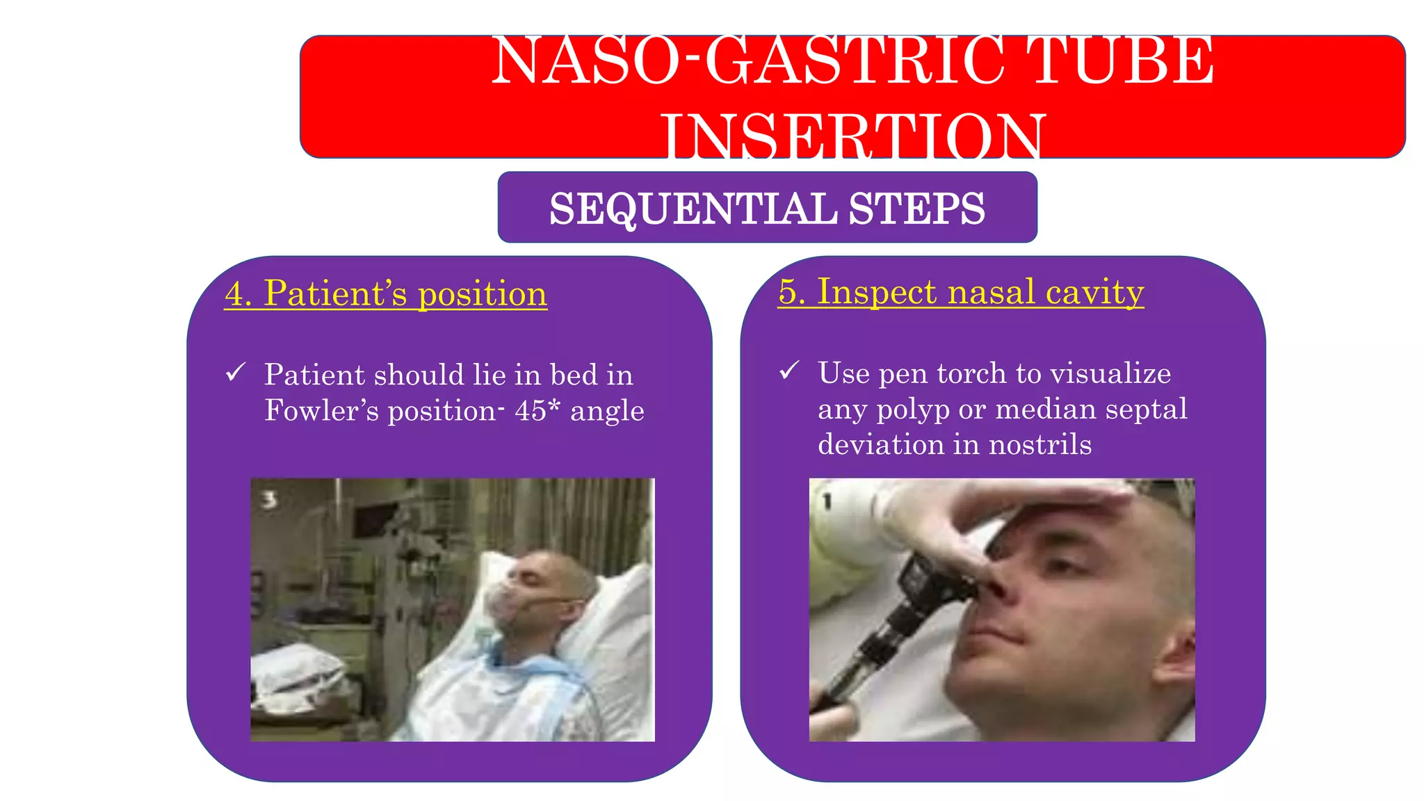 Naso gastric tube insertion- skill lab- osce | PPTX