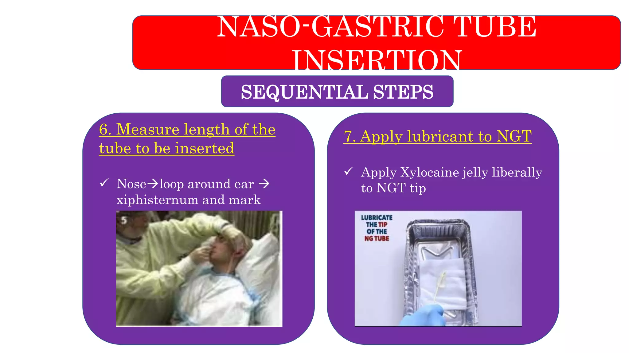 Naso gastric tube insertion- skill lab- osce | PPTX