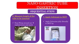 Naso gastric tube insertion- skill lab- osce | PPTX