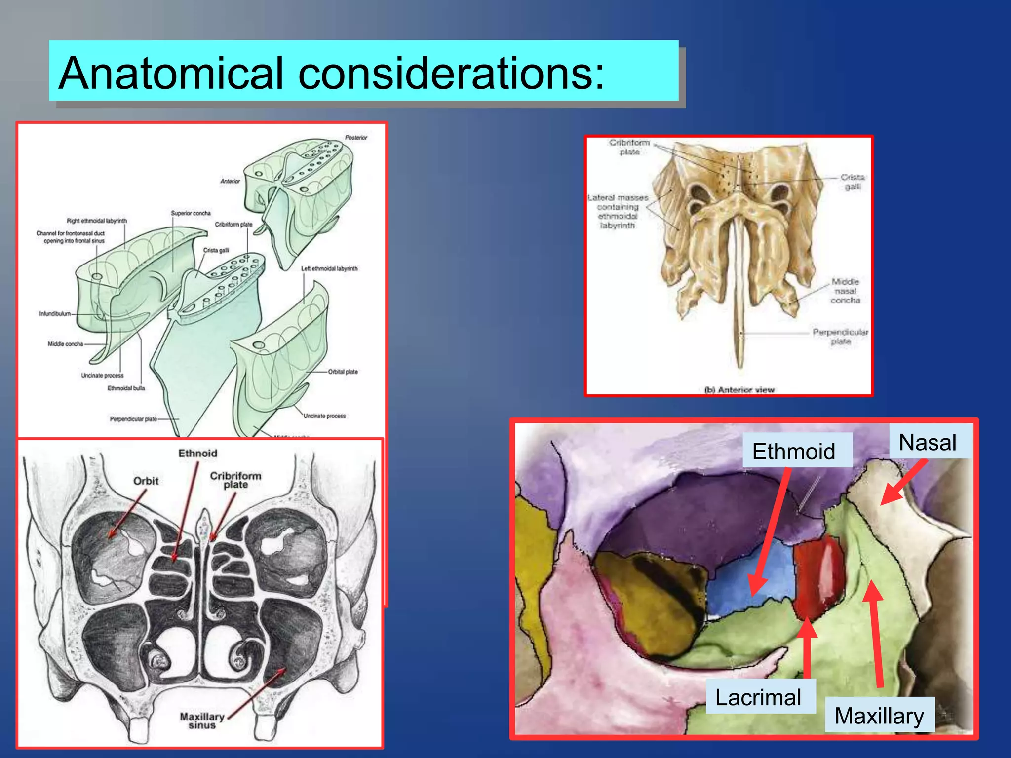 Naso orbital-ethmoid fracture | PPT
