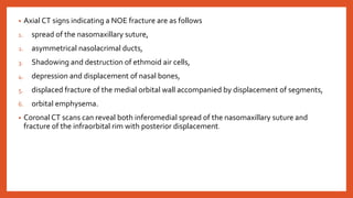 Naso orbito-ethmoid fractures | PPTX